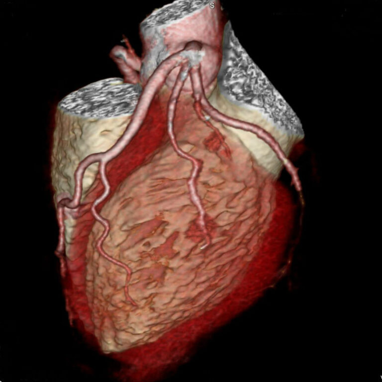 - Asian Heart and Vascular Center